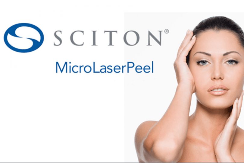 sciton-micro-laser-piel-eliminar-arrugas-cicatrices-queratosis ...